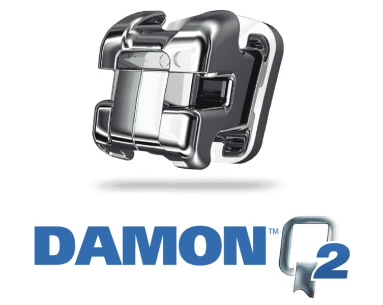 Damon Braces (Self Ligating) - The Smile Dental Lounge Johor Bahru