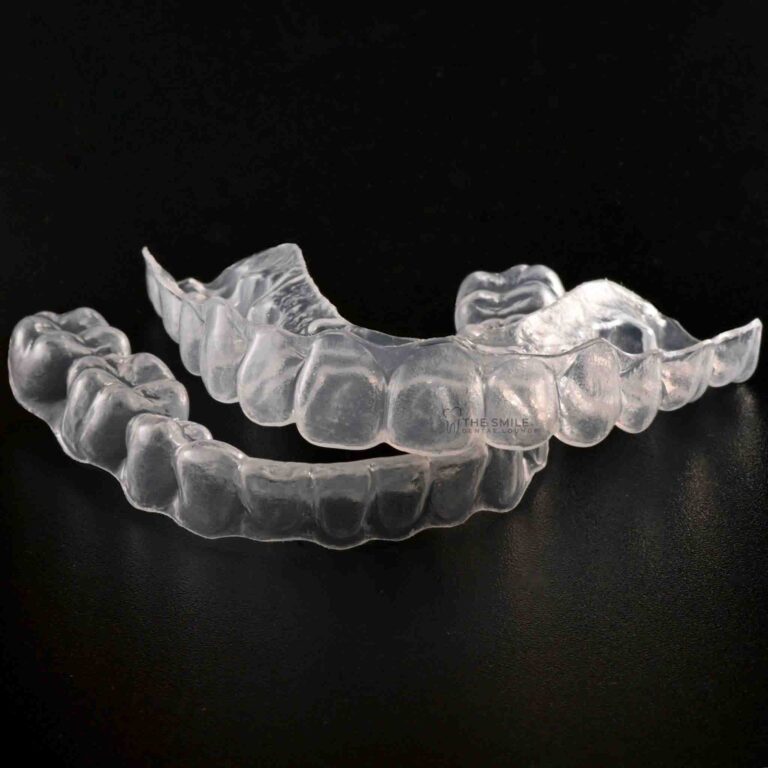 Types of Clear Retainers - The Smile Dental Lounge -Dental Clinic Johor ...